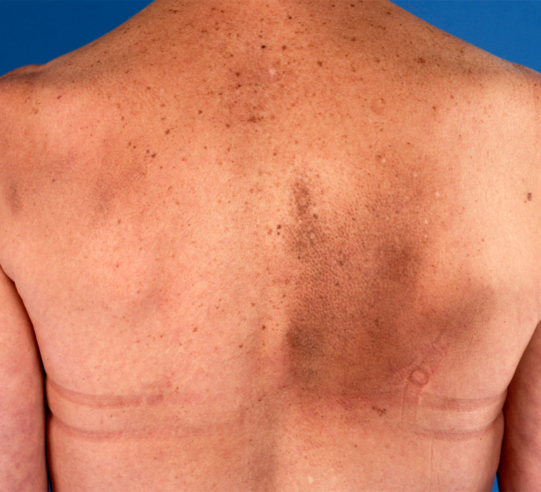 Dr. Djalma Amorim Jr. – Cirurgião de Coluna – Um Estudo Sobre a ...